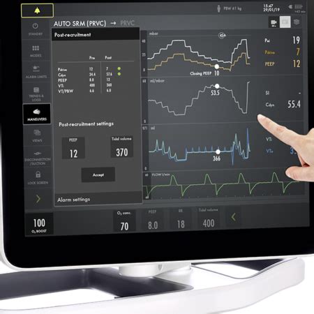 Getinge Presents Servo U With Personalized Lung Protection To Make Complex Procedures Easier