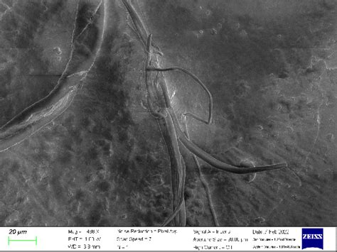 Figure 4 From Printed Wearable Pressure Sensor Using Interdigitated Capacitor For Application In