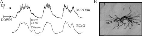 A Simultaneous Recording Of A Msn Vm And The Frontal Ecog In An Download Scientific Diagram