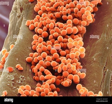 Lactococcus Lactis Bacteria Coloured Scanning Electron Micrograph Sem This Lactic Acid