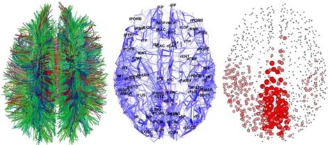 Brain Connections Resting State Fmri Functional Connectivity
