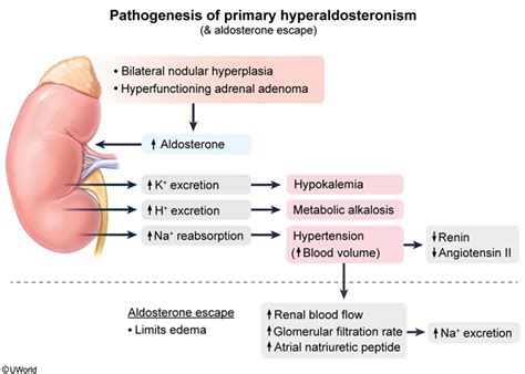 Secondary Hypertension Cardiology Uworld Medical Library