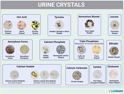 Urinary Crystals Types Causes And Clinical Significance