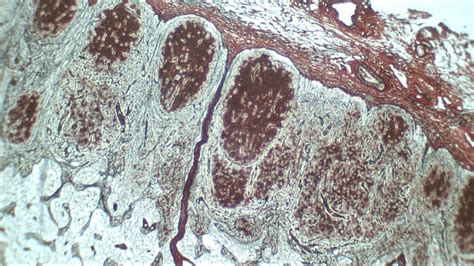 Solved Label The Capsule Medulla Cortex Nodule And