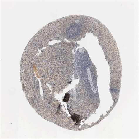 Tissue Expression Of Myc Staining In Spleen The Human Protein Atlas