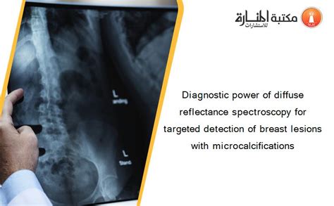 Diagnostic Power Of Diffuse Reflectance Spectroscopy For Tar