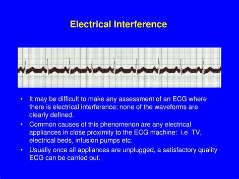 What Causes Electrical Interference At Craig Cox Blog