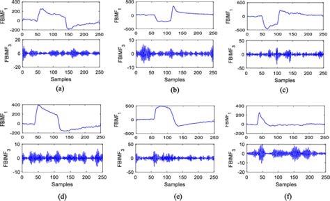 Figure 1 From Automated Eye Movement Classification Based On Emg Of Eom