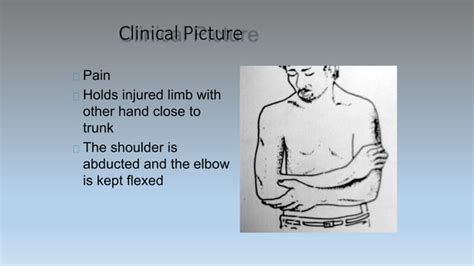 Shoulder Dislocation Types And Management Methods Of Reduction Pptx