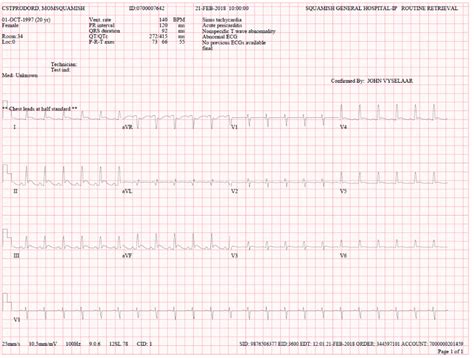 Place ECG Orders And View Results ED
