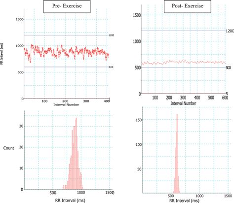 figure 1 from cardiac autonomic control in elite juvenile cyclists