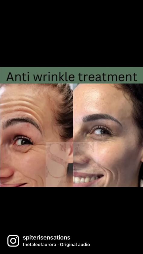 💕💉oh I Will Never Stop Loving These Results💉💕📣 Fun Fact After Using