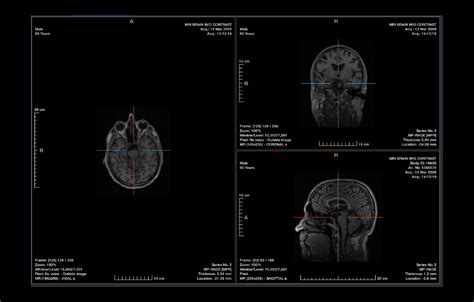 Qp Brain® Quibim Website