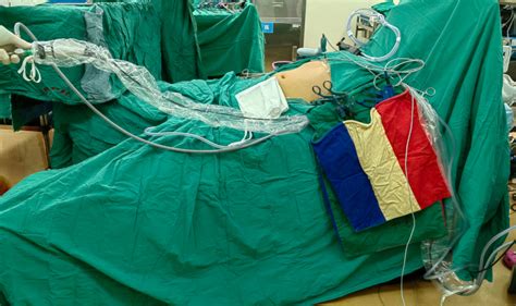 Laparoscopic Anatomical Liver Segment Vii Resection With Liver Parenchymal Transection Following