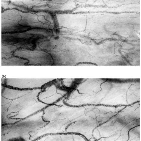 Typical Sublingual Microcirculatory Images Taken With A Cytocam Idf Download Scientific Diagram