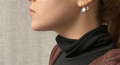 What Options Are There To Make My Jaw More Defined And My Neck ‘slimmer R Cosmeticsurgery