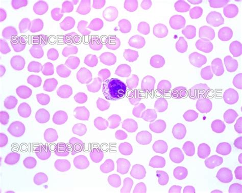 Human Blood Smear Monocyte Stock Image Science Source Images