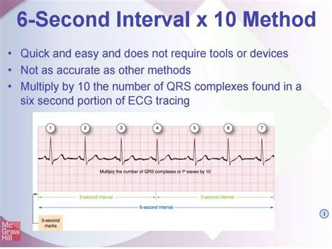 Basic Dysrhythmia Interpretation Pptx