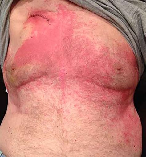 Syndromes Treat Cure Fast