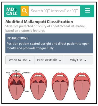Modified Mallampati Scoring Is As Follows Class 1 Tonsils Uvula And