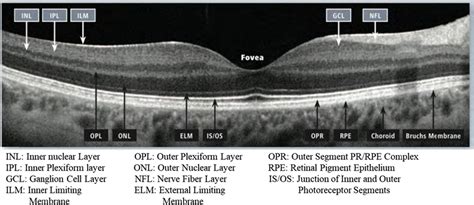 Oct Image Captured By Centering On Fovea Depicting Its Various Layers