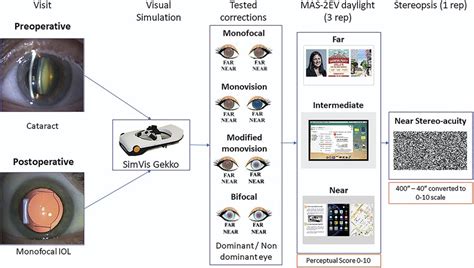 Cataracts Vision Simulator
