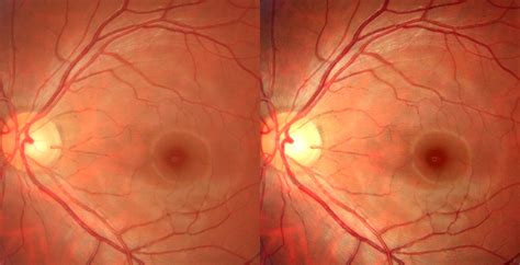 基于 Opencv 的图像亮度、对比度与锐度调节opencv 亮度调整 Csdn博客