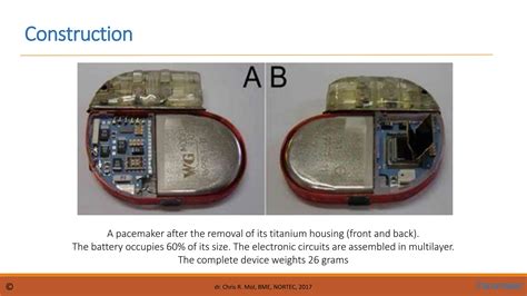 Cm Pacemaker Pp Pptx