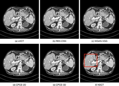 3d Convolutional Encoder Decoder Network For Low Dose Ct Via Transfer Learning From A 2d Trained