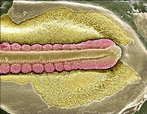 Paraxialt Mesoderm By Jakke Neiro Philomelos