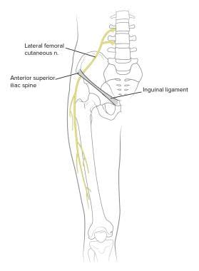 Meralgia Paresthetica Background Pathophysiology Epidemiology