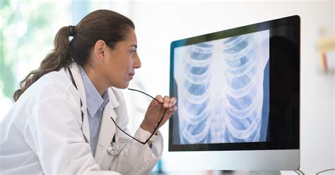 Australias Csiro Develops Multimodal Ai For Smarter Cxr Reading Mobi