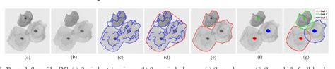 Figure 1 From A Novel Unet Decoding Strategy For Cervical Cell Mass