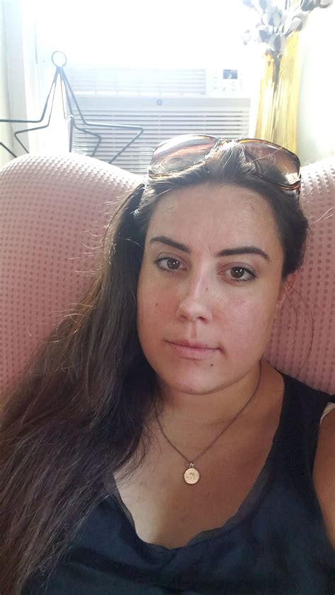 Pyoderma Faciale Rosacea Fulminans Pfrf