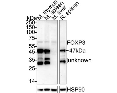 Foxp3 Recombinant Rabbit Monoclonal Antibody [psh07 47] Ha722835 Huabio