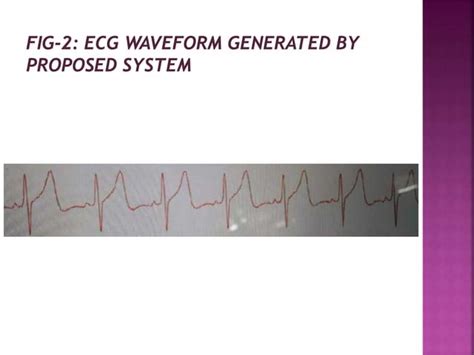 arduino based health monitoring system ppsx