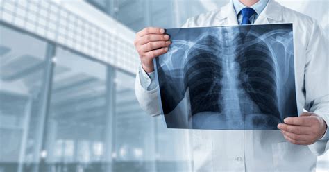 What Is Radiology Procedures And Benefits