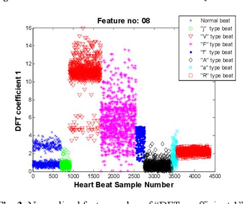 Figure 1 From Nature Inspired Algorithm Mabc For Clustering And Classification Of Ecg Heart