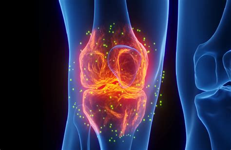 خيوط ذهبية في ركبتي امرأة كورية تربك الأطباء Rt Arabic