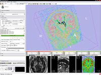 Announcements Slicer3 4 Slicer Wiki Announcements Slicer3 4 Slicer Wiki