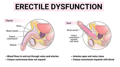 Understanding Erectile Dysfunction Causes Treatments And Lifestyle