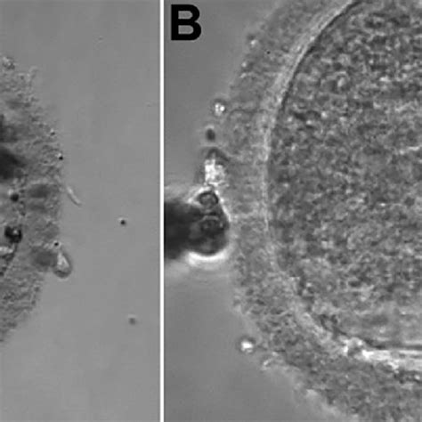 A Oocyte In Metaphase Ii B Oocyte Mii Fertilized With 04 Pronuclei Download Scientific