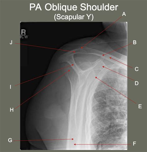 Shoulder Scapular Y Pa Oblique Diagram Quizlet