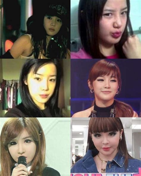 박봄 얼굴 변천사 성형 전 외모 찾아보니…‘애니모션 리즈 시절 유혜지 기자 톱스타뉴스