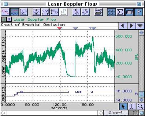 Laser Doppler Flowmetry Ldf Download Scientific Diagram