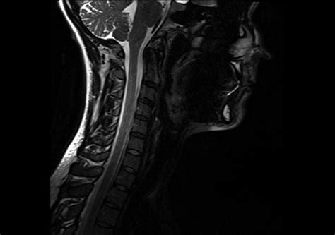Anatomical Registration Between Sessions Sct