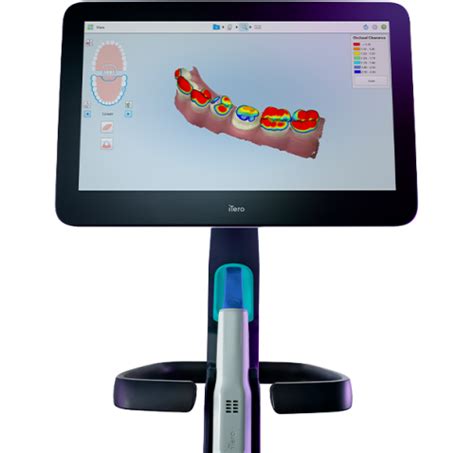 Align Itero 5d Benco Dental