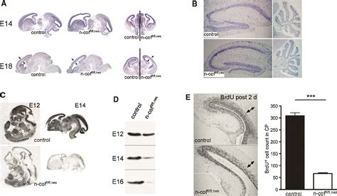 N Cofilin Is Associated With Neuronal Migration Disorders And Cell