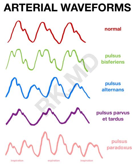 Abnormal Arterial Waveforms Rkmd