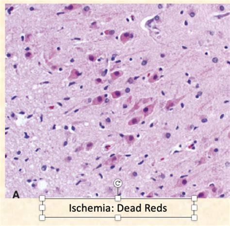 Cell Patterns Flashcards Quizlet